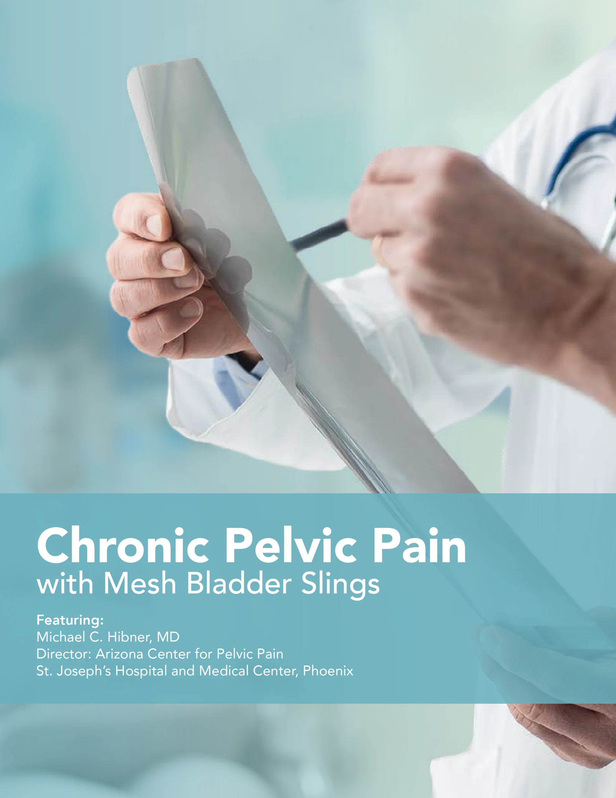 Chronic Pelvic Pain With Mesh Bladder Slings - Vigna Law Group